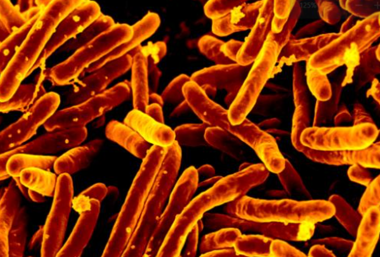 Waspada dengan Bakteri Penyebab Tuberkulosis! – TB Indonesia